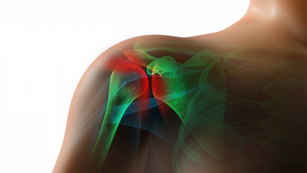 Rotator Cuff Dysfunction – 8 CEU’s (January) ** 6 SEATS REMAIN ...